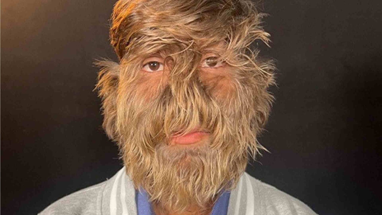 Así luce el hombre que se llevó el récord Guinness a la cara más peluda ...