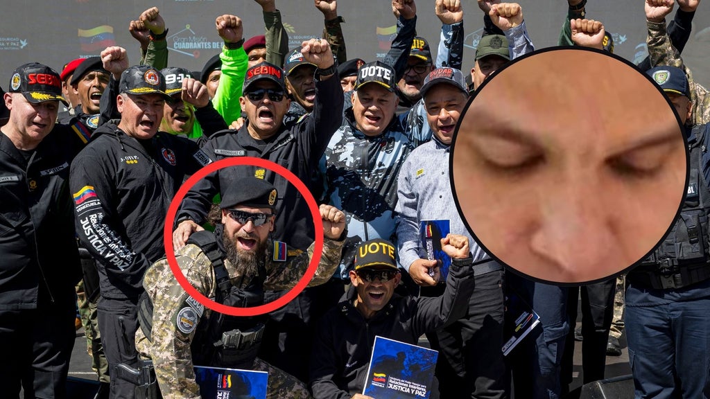 El drástico cambio de look de Granko Arteaga, considerado el máximo ...