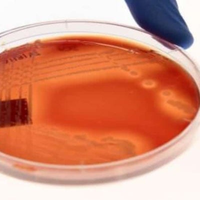 Halicina: el antibiótico creado por inteligencia artificial en Estados ...