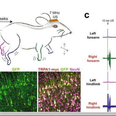 Investigadores logran manejar neuronas con ultrasonido | NTN24.COM